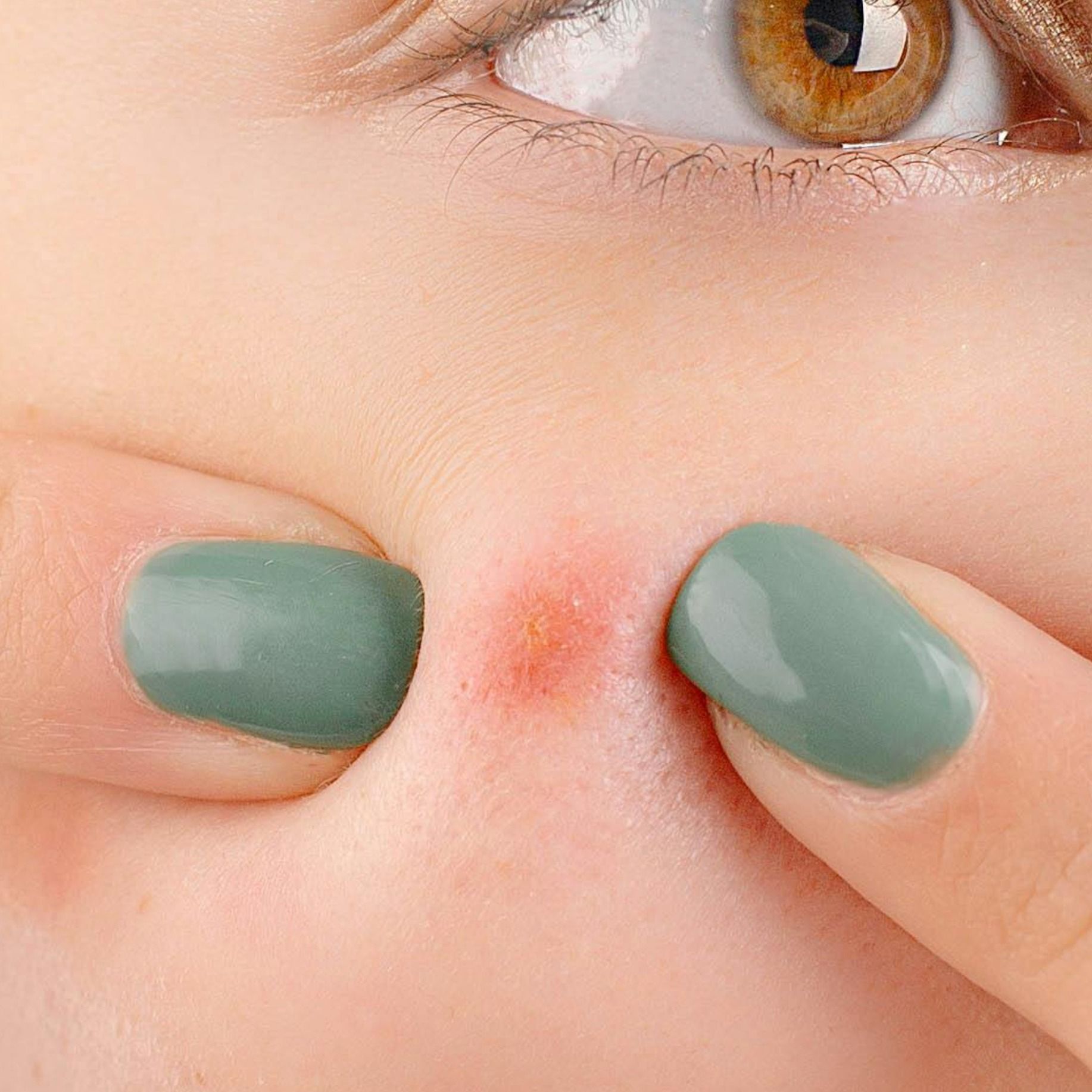 Do you remember the band "Zit Remedy?" - Seekr